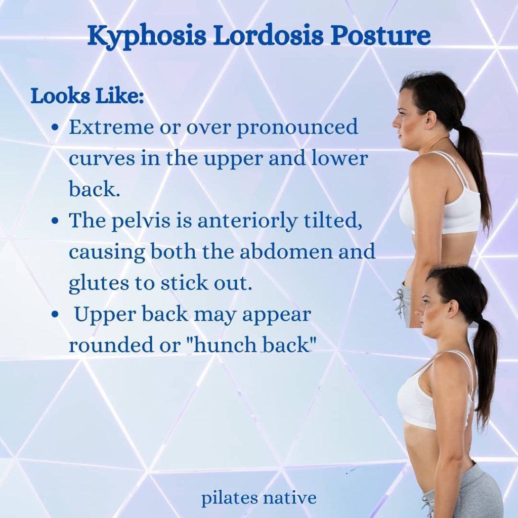 Standing Posture: Kyphosis Lordosis – PILATES NATIVE